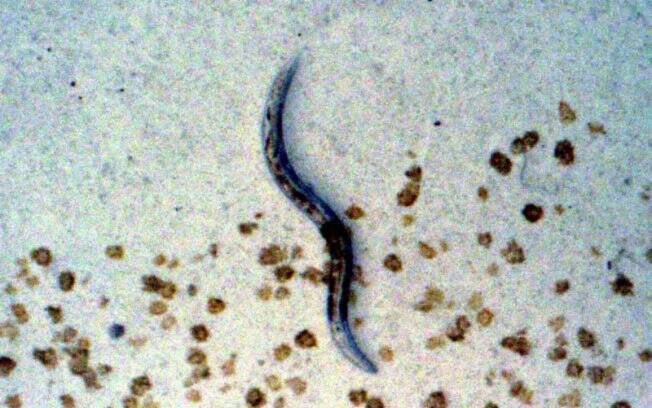 Prolongar a vida dos vermes pode ajudar a melhorar a vida humana ...